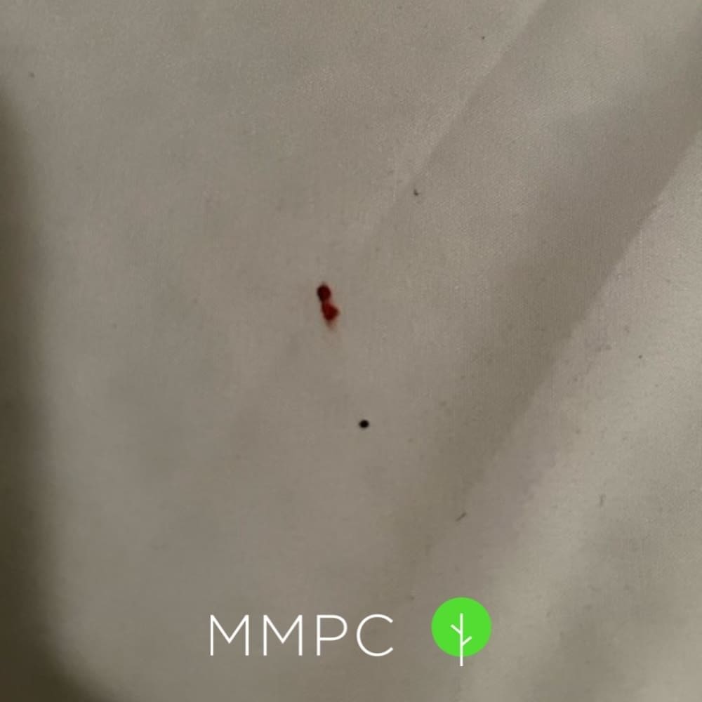Early Signs of Bed Bugs - MMPC